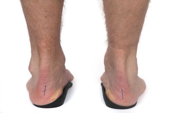 Can foot pain cause back pain? | Toorak Villiage Podiatry Blog